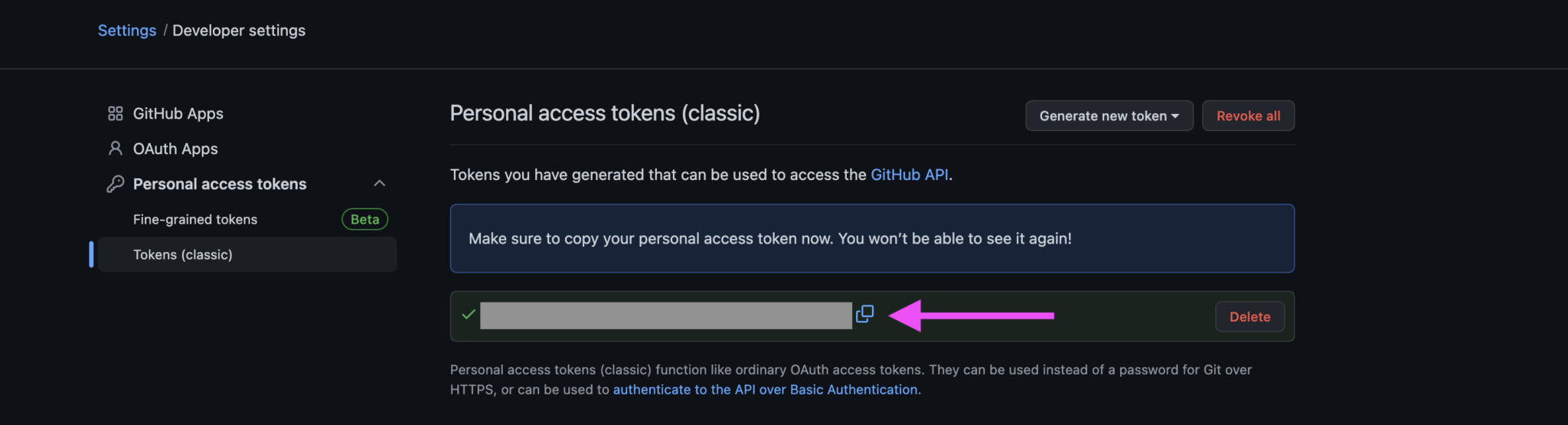 【AWS CDK】GitHub の Release をトリガーに CodePipeline を起動する（GitHub ソースアクション Version 1 版） | DevelopersIO